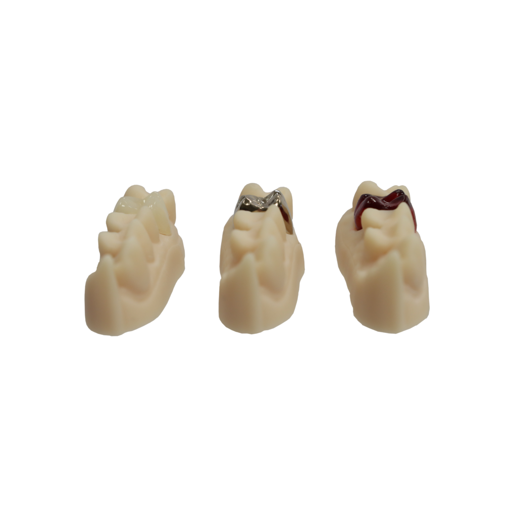 [WHIP MIX] VeriCAST Resin, 1kg - APEX ON TECH